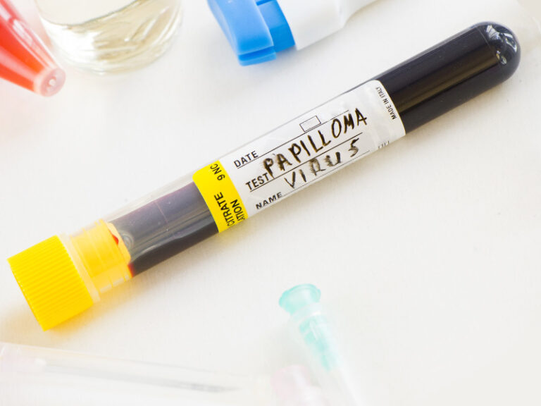 A Complete Guide to Blood Tests for STDs - STELLA MATTINA LLC